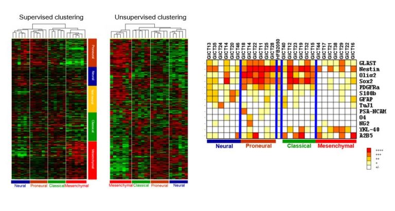 Molecular classification of glioma stem cells – Atlas of Science